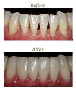 #5 Benefits of Bioclear Treatment | A Comprehensive Guide