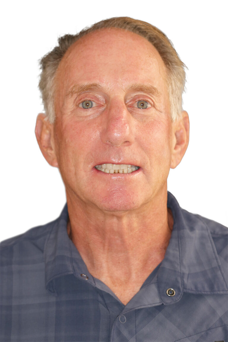 How Bioclear Works: A Dental Transformation